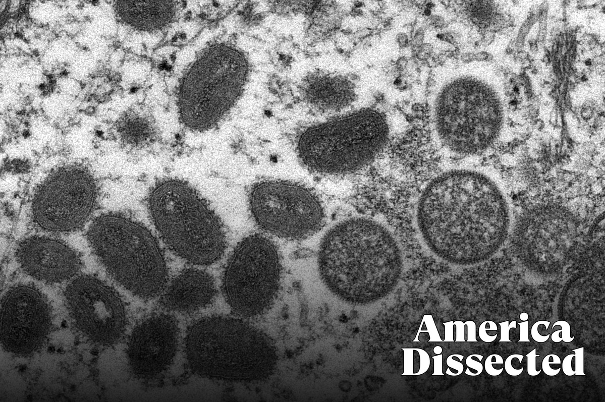 Monkeypox! with Prof. Anne Rimoin | Crooked Media